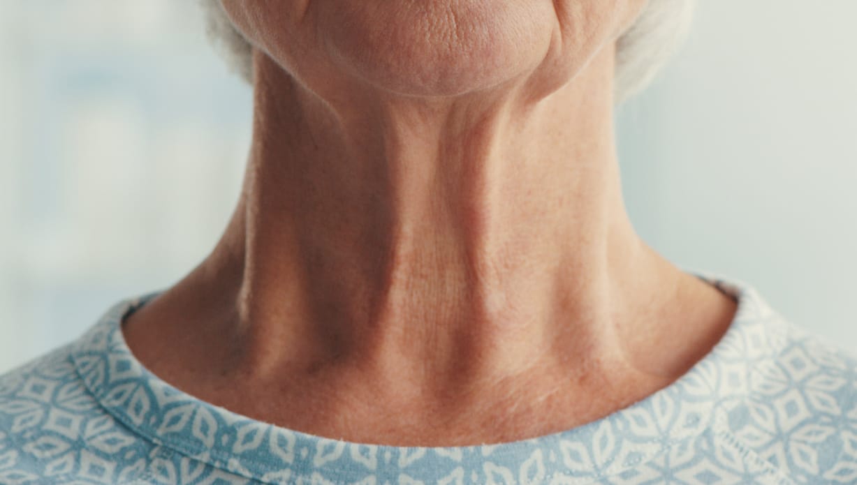 Botox in the Neck: Platysmal Banding Treatment - Mountain Radiance ...